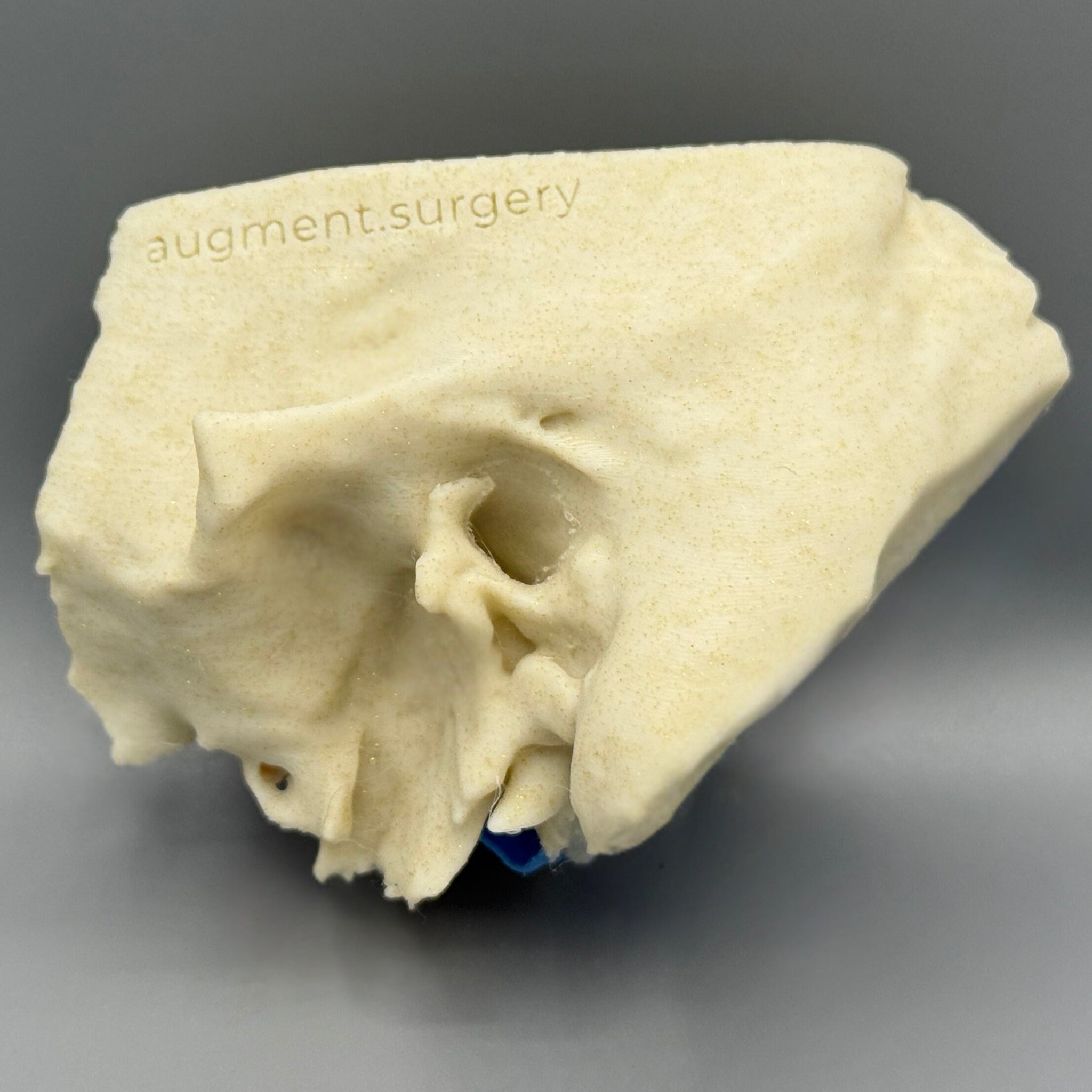 The 3D Temporal Bone Collection - 12+ Surgical Simulators – Augment Surgery