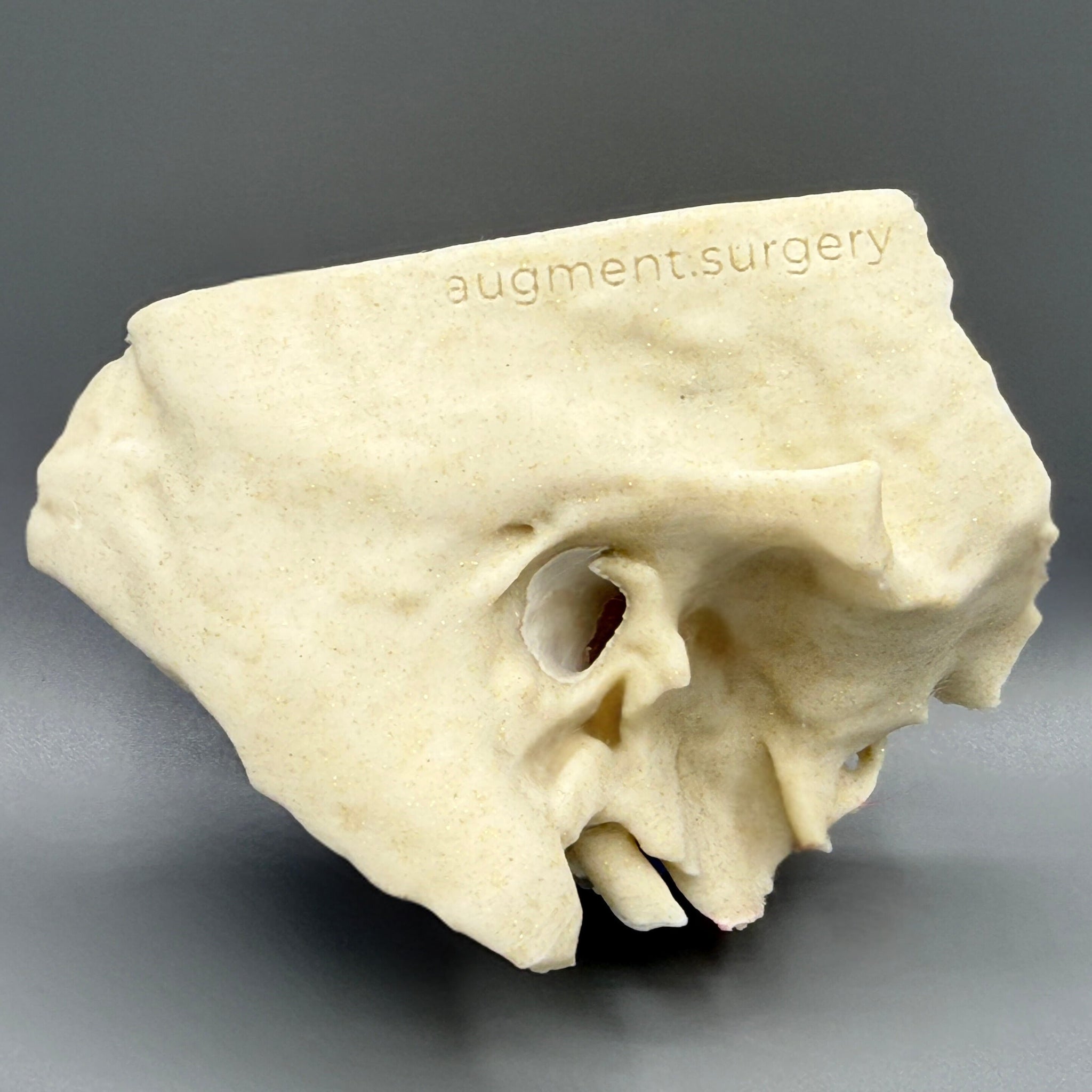 The 3D Temporal Bone Collection - 12+ Surgical Simulators – Augment Surgery