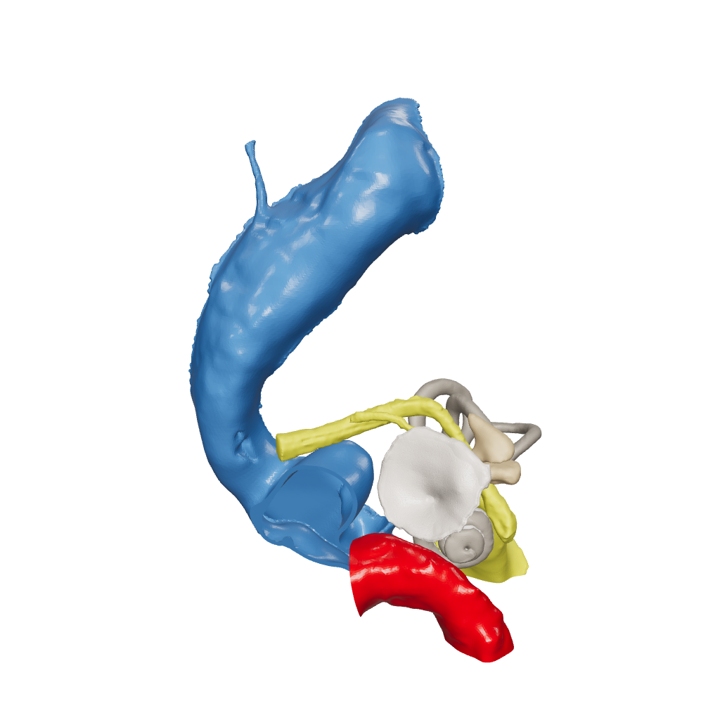 The 3D Temporal Bone Collection - 12+ Surgical Simulators – Augment Surgery